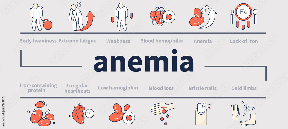 Anemia disease infographics. Disease symptoms layout, info chart ...