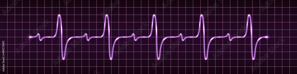 Electric impulse signal, heart beat pulse display. Oscilloscope ...
