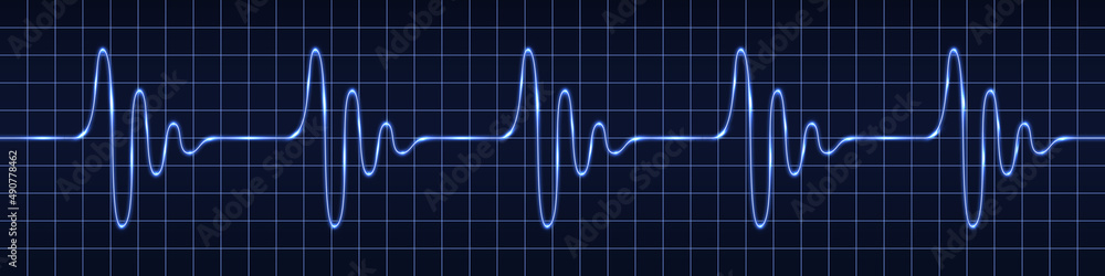 Heart beat pulse. Sine wave impulse signal. Oscilloscope monitor ...