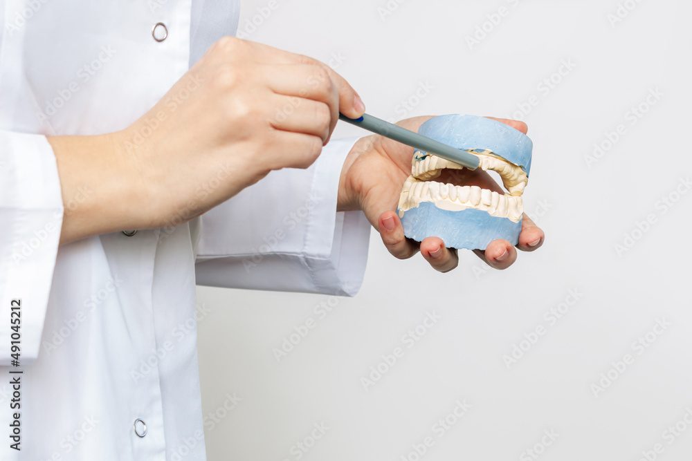 A plaster cast of teeth in the hands of doctor in a white coat pointing ...