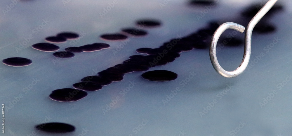 Microbiological cultures and inoculation loop used in microbiology ...