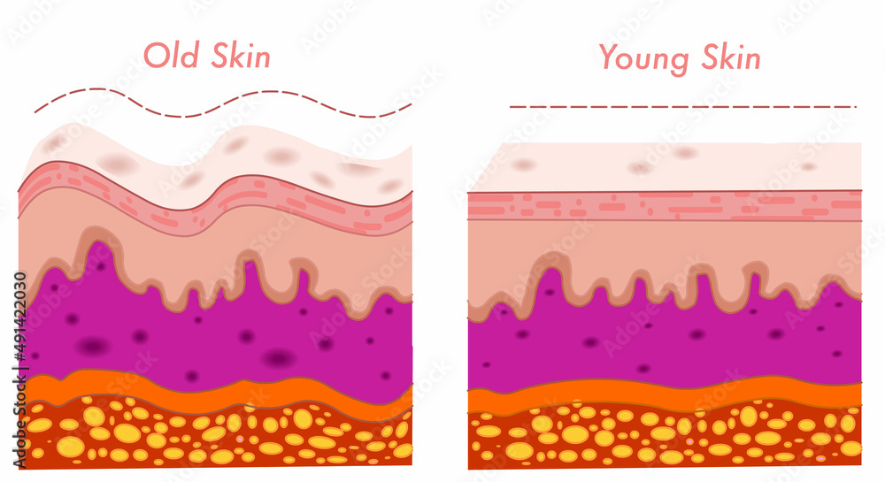 Old skin young skin, differences between. Elastic aging wrinkled ...