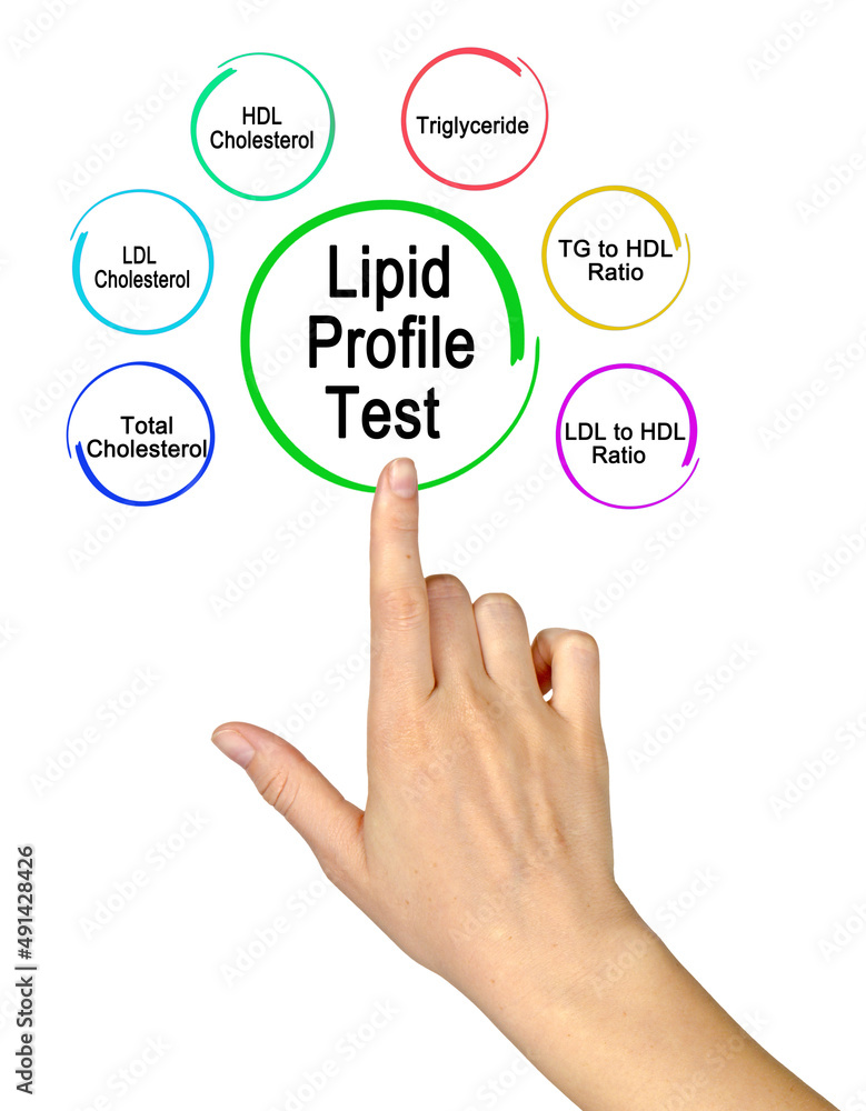 Six components of Lipid Profile Test Stock Photo | Adobe Stock