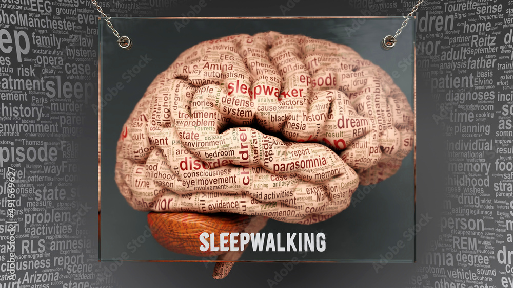 Sleepwalking anatomy - its causes and effects projected on a human ...