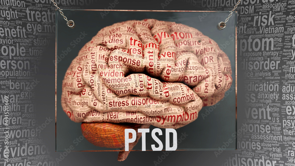 Ptsd anatomy - its causes and effects projected on a human brain ...