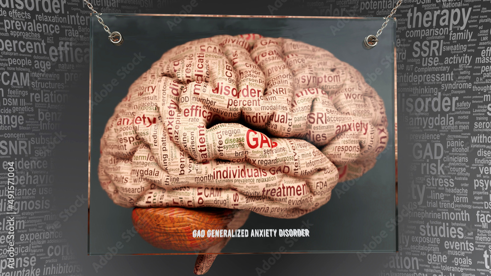 Gad generalized anxiety disorder anatomy - its causes and effects ...