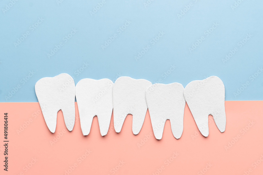 Crowding tooth cartoon made from paper. Problems resulting from dental ...