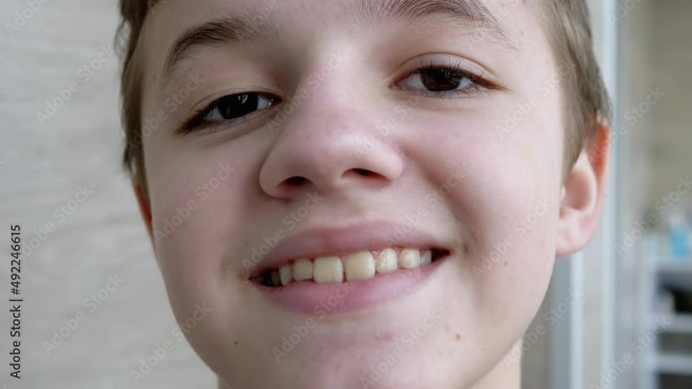 Close-up of the Face of a Smiling Child Showing Teeth. Teenager laughs ...