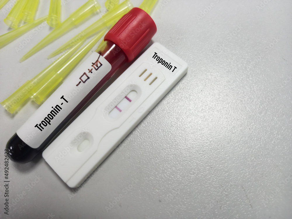 Blood sample with rapid test cassette for Troponin-T test, cardiac ...
