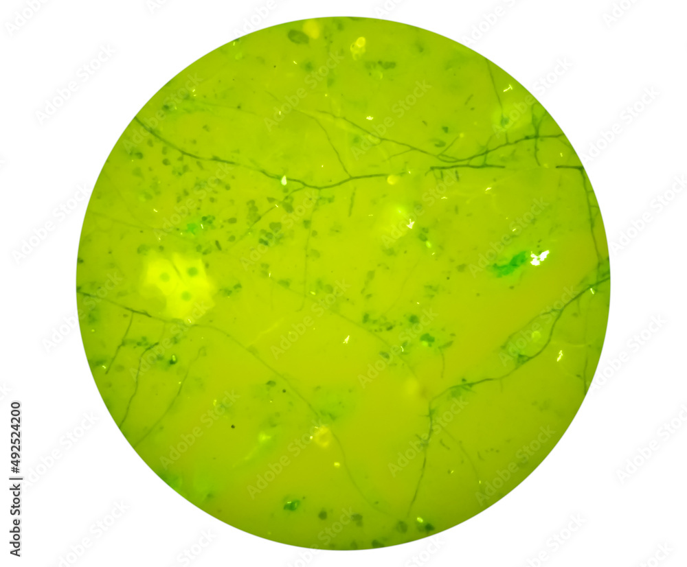 Microbacterium Tuberculosis Bacteria (MTB) light color and rod shape ...