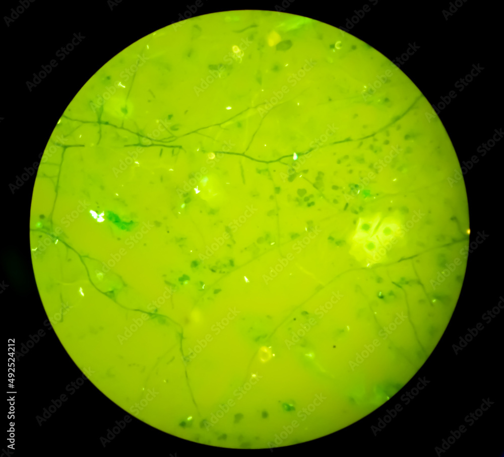 Microbacterium Tuberculosis Bacteria (MTB) light color and rod shape ...