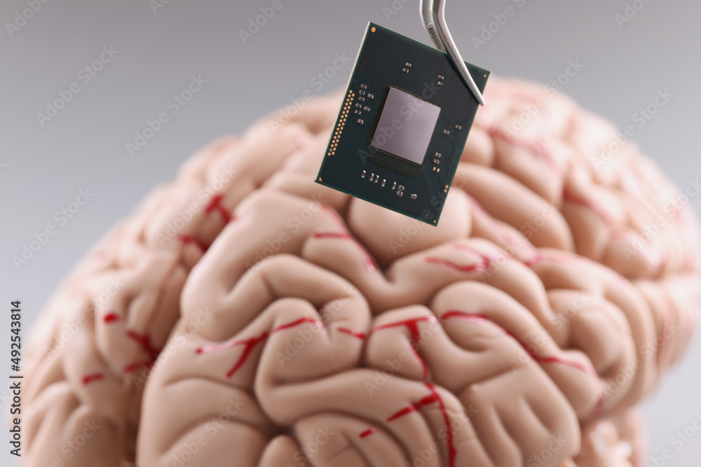 Tiny Hand Brain