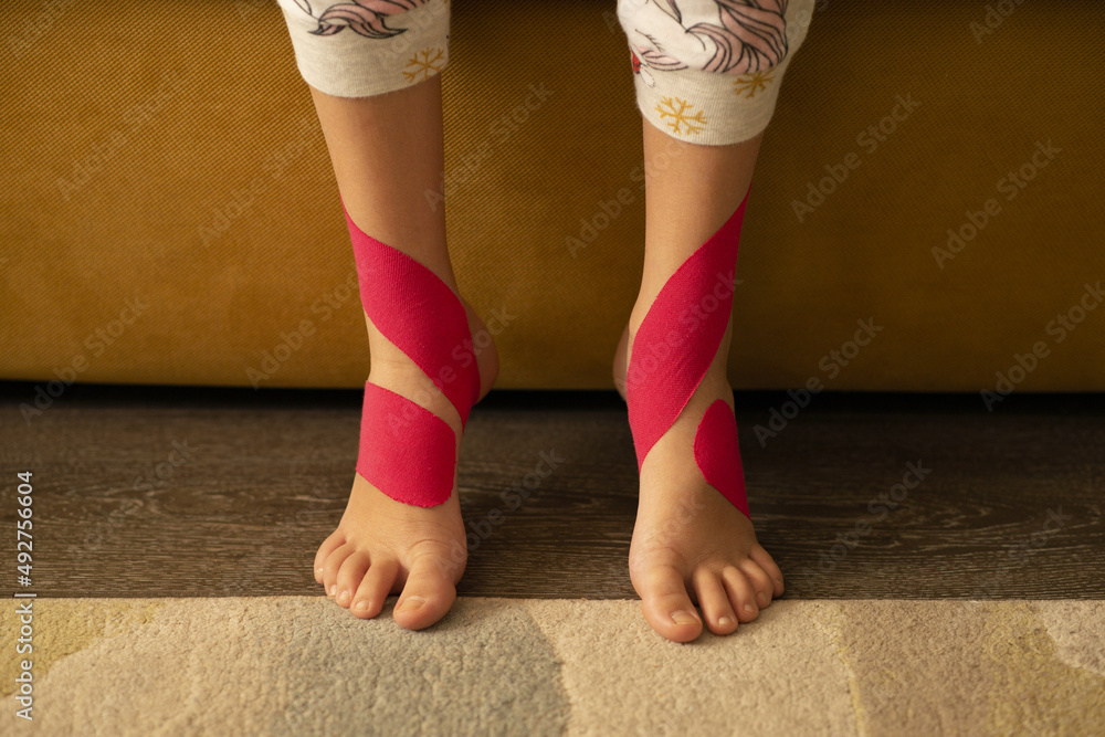 Physiotherapy treatment of knee injury With correction tape for improve ...