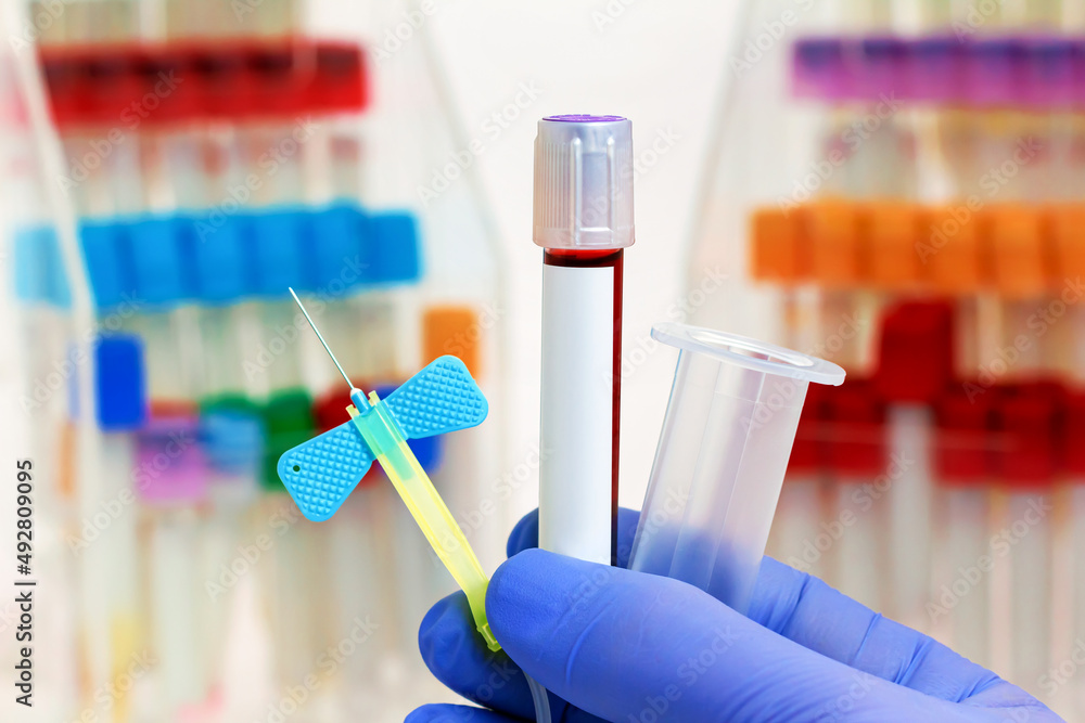 doctor with catheter with holder adapter and tube with blood sample ...