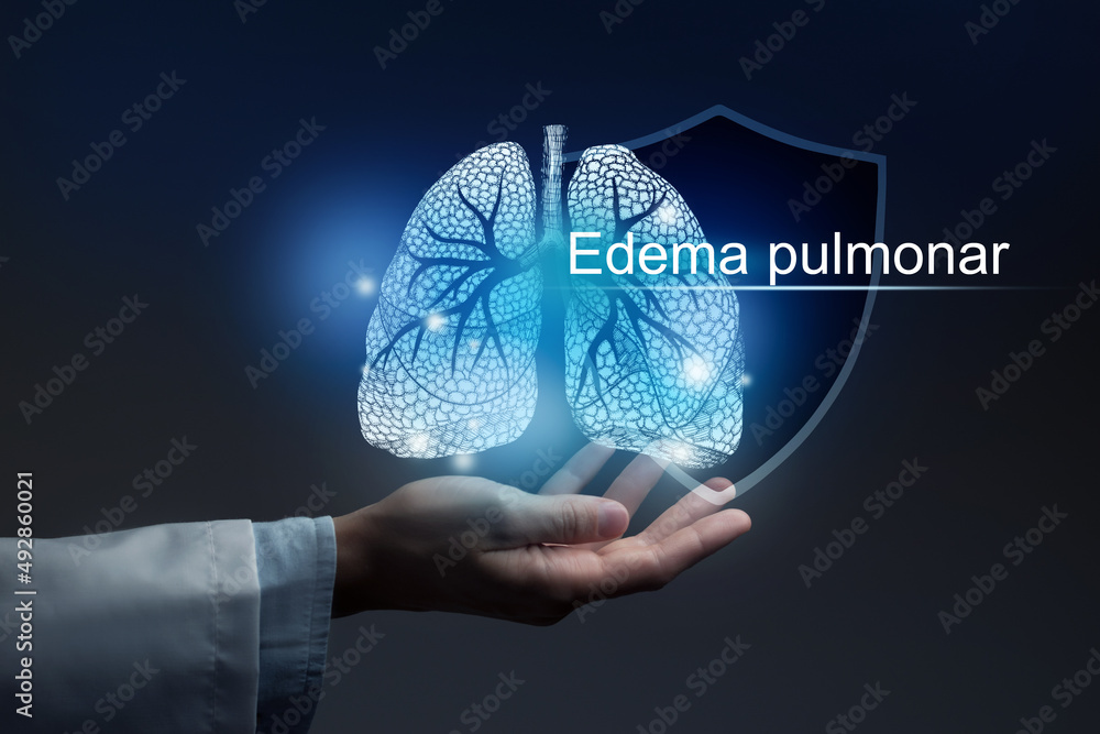 Medical banner Pulmonary edema with spanish translation Edema pulmonar ...