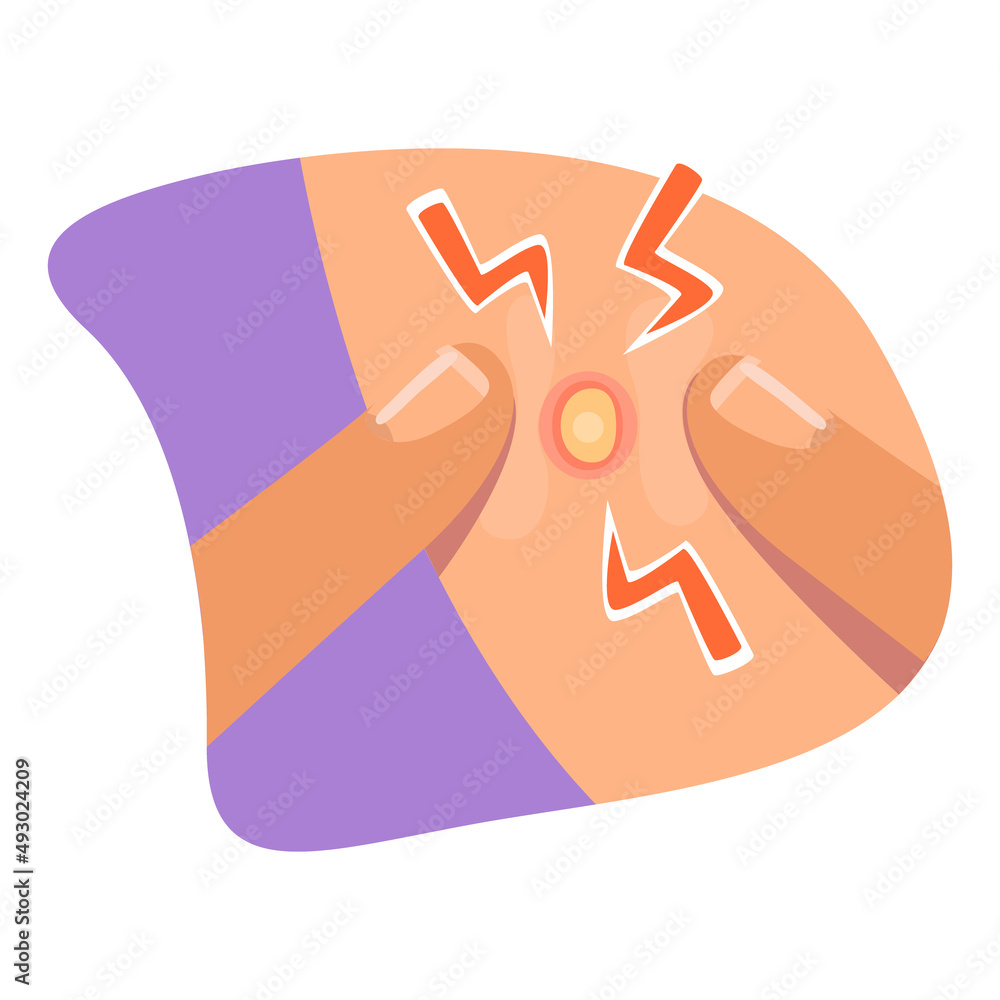 Squeeze painful pimples with fingers 2D vector isolated illustration ...