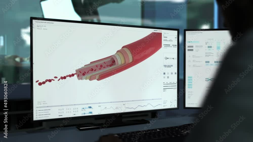Scan Of Human Blood Cells In Science Laboratory Research System ...