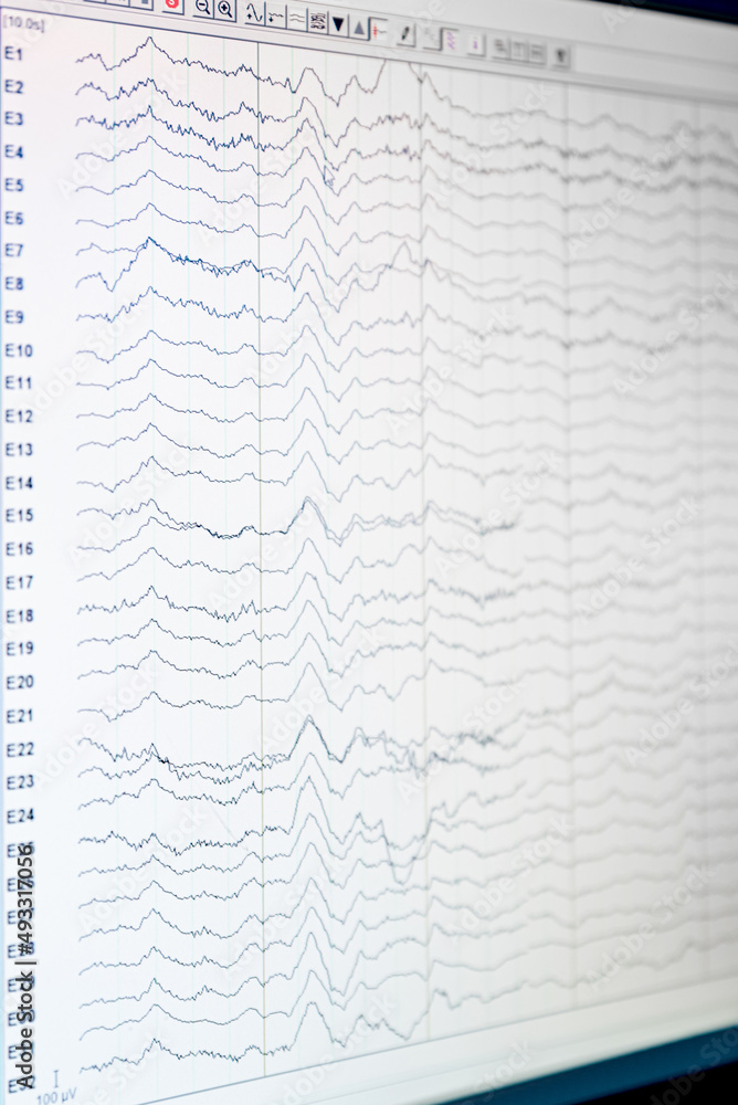 Electroencephalogram showing rhythm of brain activity Stock Photo ...