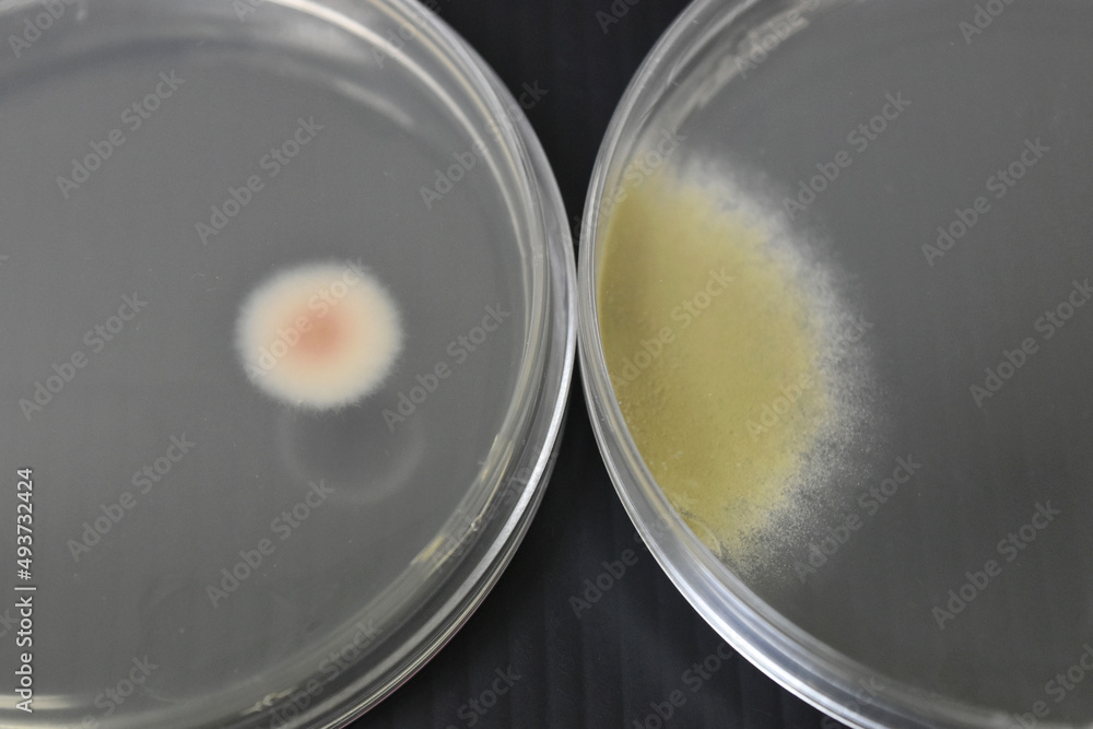 Colonies of bacteria growth on agar plate medium Stock Photo | Adobe Stock