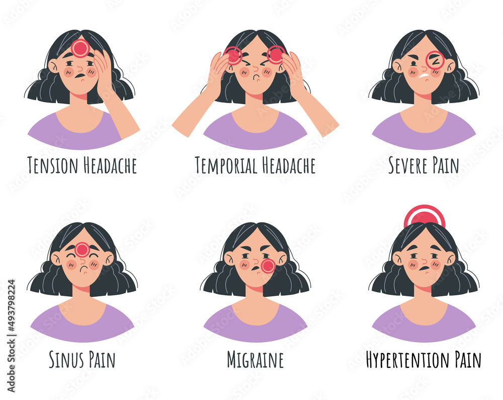 Types head aches design element illustration set Stock Vector | Adobe Stock