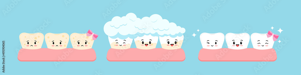 Cute tooth with plaque, whitening stage kids clean tooth in gym before ...