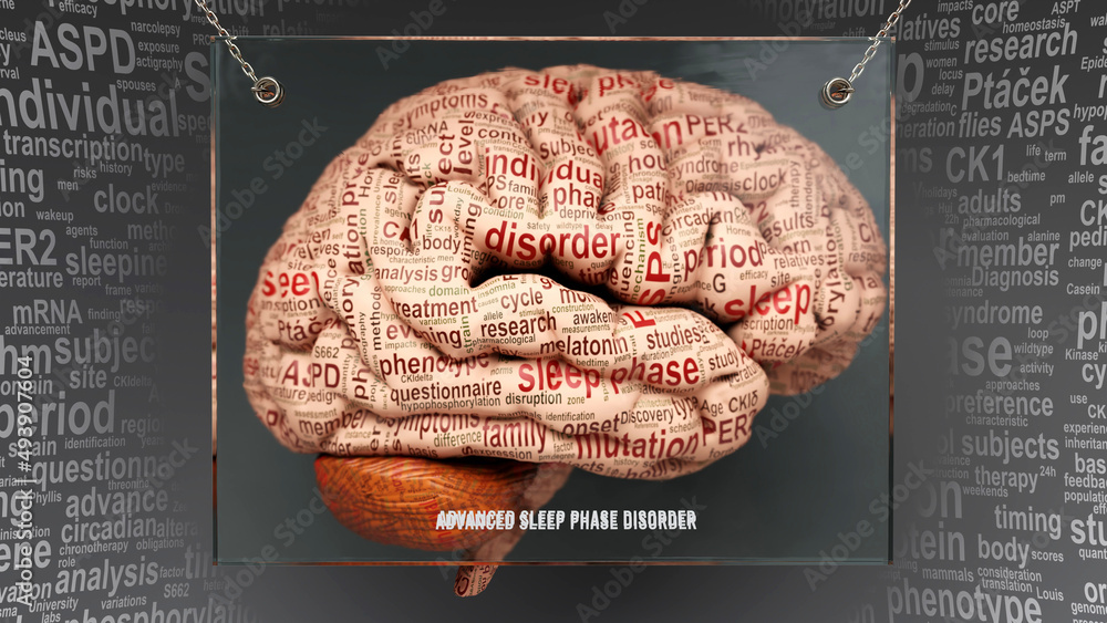 Advanced sleep phase disorder anatomy - its causes and effects ...