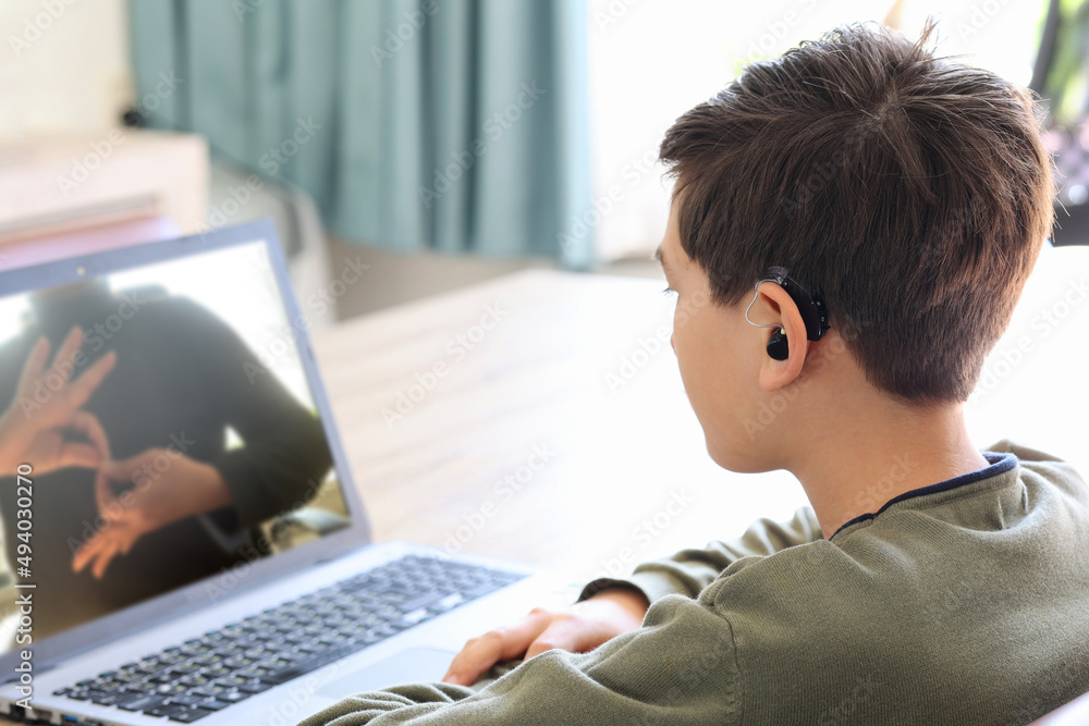 Deaf teenager boy Wearing Hearing Aid using Laptop. Disable student ...