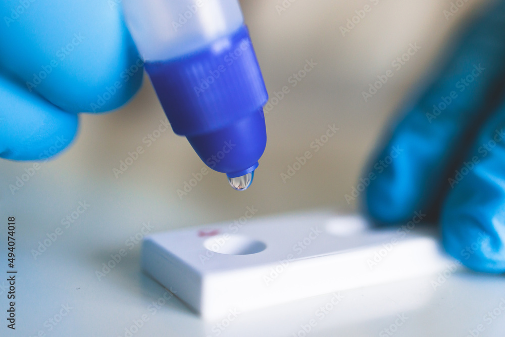 Process of express fast coronavirus covid Antigen AG PCR testing ...