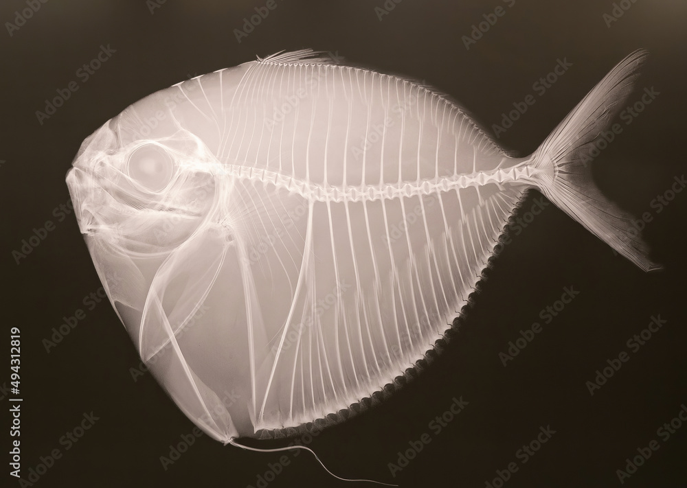 Poster An X ray image showing the skeleton of a Moonfish – Wall Art ...