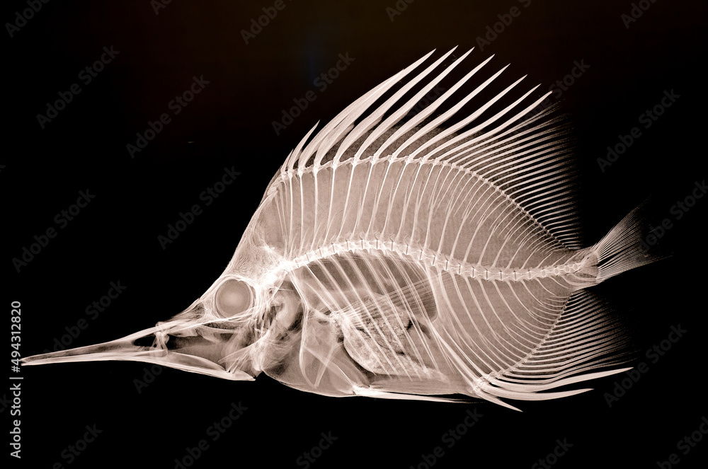 An X ray image showing the skeleton of a Long Nosed Butterfly fish ...