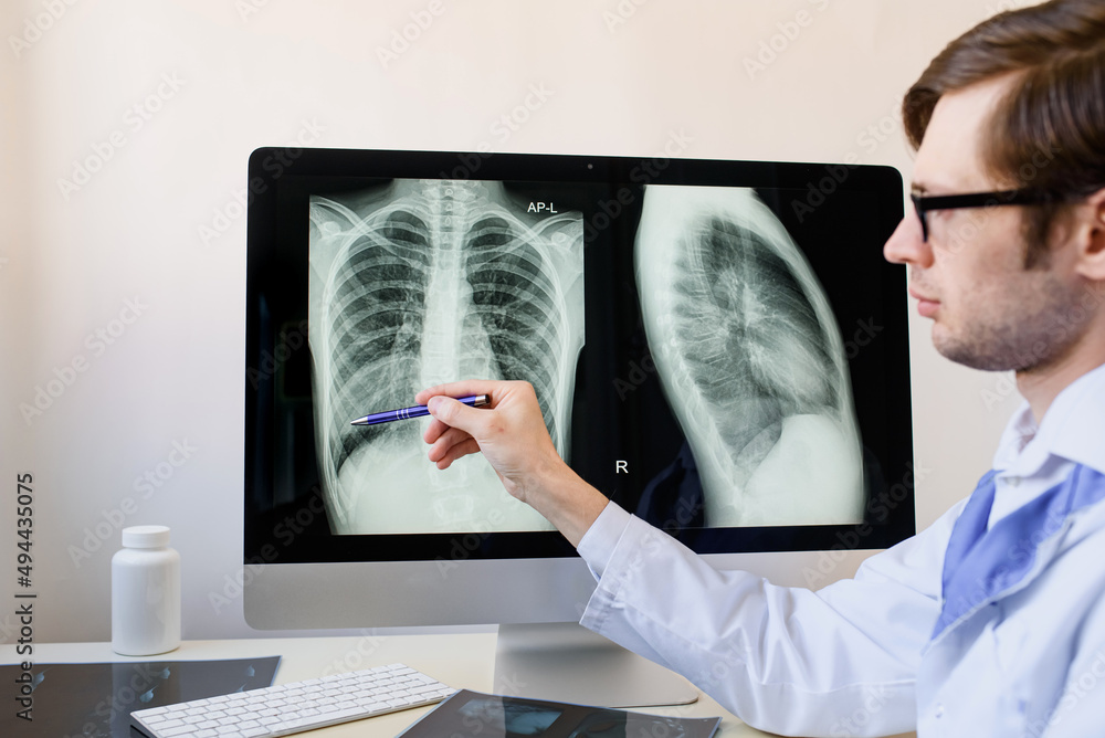 Radiologist analyzing a chest x-ray with pneumonia in right hemithorax ...