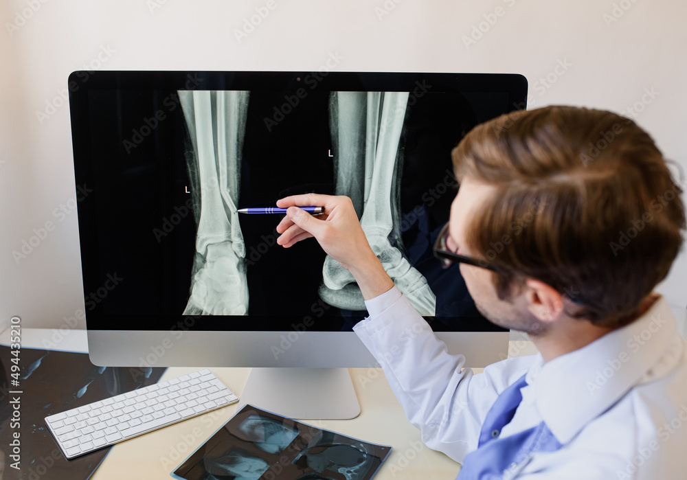 Radiologist analyzing a football player patient x ray with a fibula ...