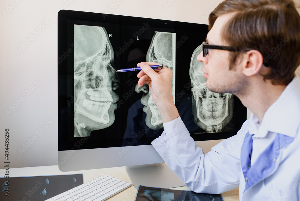 Forensic radiologist doctor analyzing a nasal bone fracture Stock Photo ...