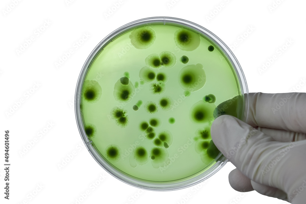 Hand with Petri dish or culture media with bacteria on white background ...