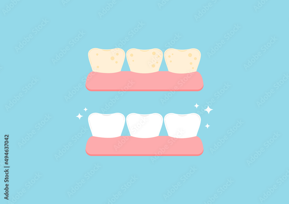 Tooth bleaching health and tooth with yellow plaque before, after icon ...