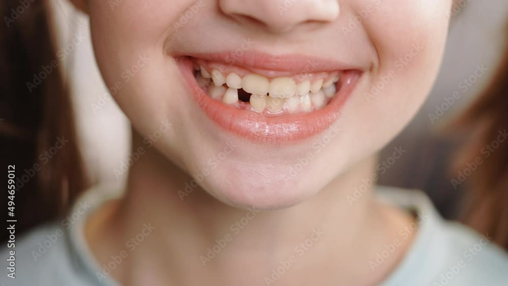 Little girl with tooth first milk temporary tooth. Dental medicine or ...