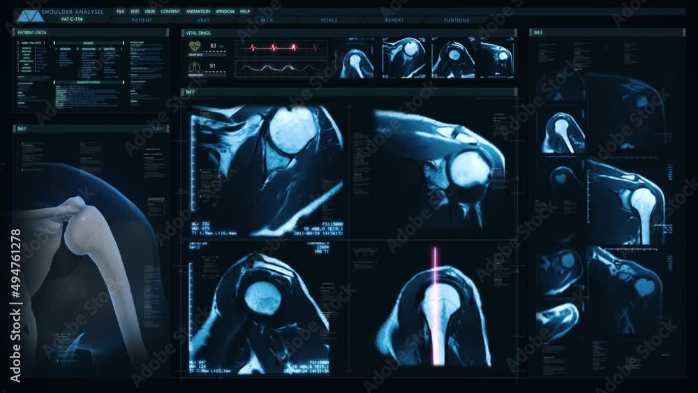 Futuristic Technological Interface Analyzing Human Anatomy. Medical ...