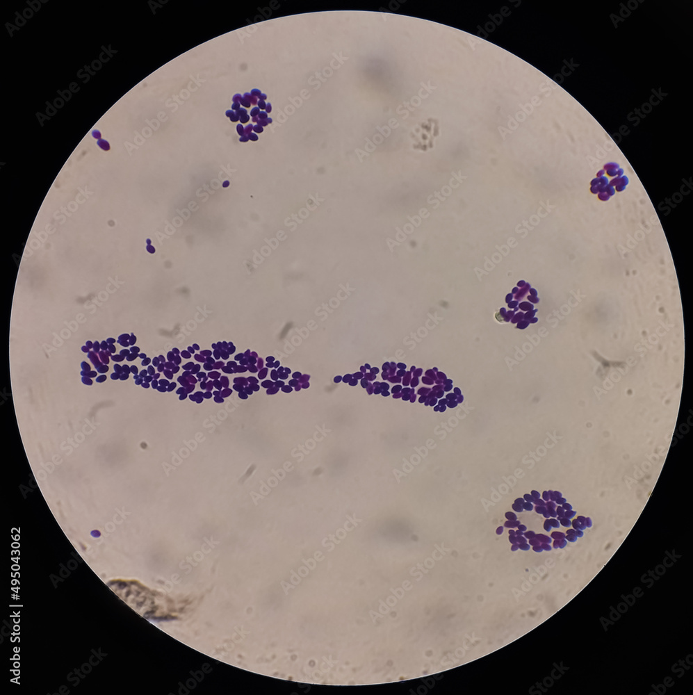 Candida spp, fungi, emerging multidrug fungus. Candida albicans, C ...