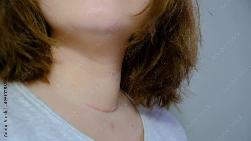 Vídeo do Stock: Girl's neck in motion close-up. Mark on the neck after ...