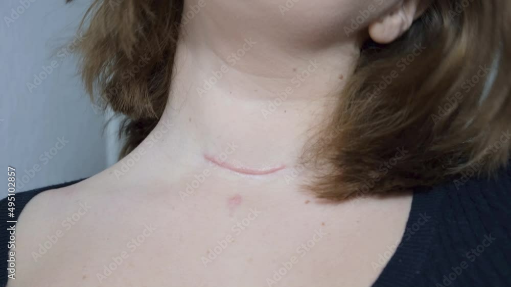 Vidéo Stock Girl's neck in motion close-up. Mark on the neck after ...