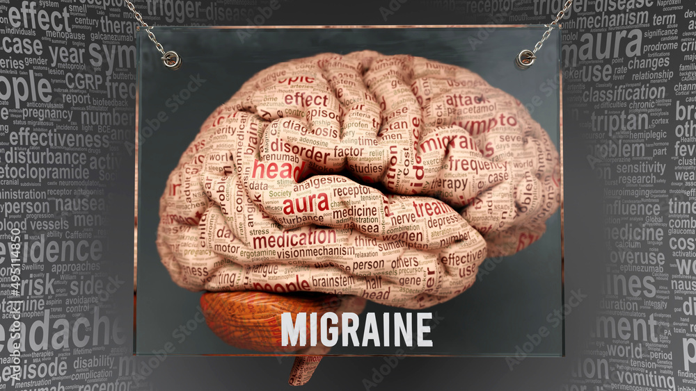 Migraine anatomy - its causes and effects projected on a human brain ...