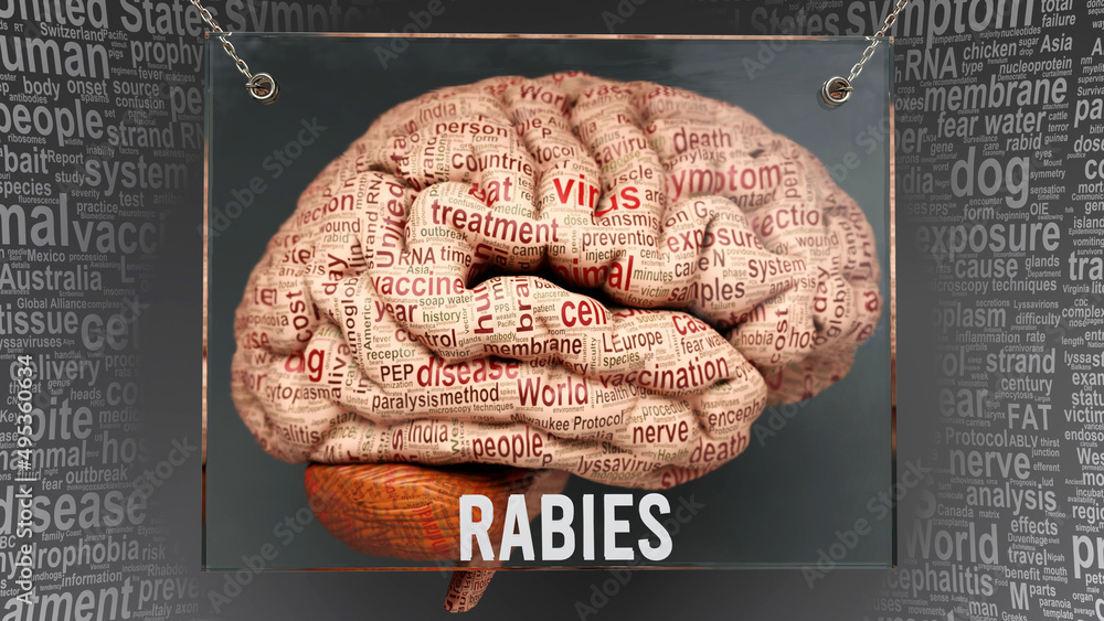 Rabies anatomy - its causes and effects projected on a human brain ...