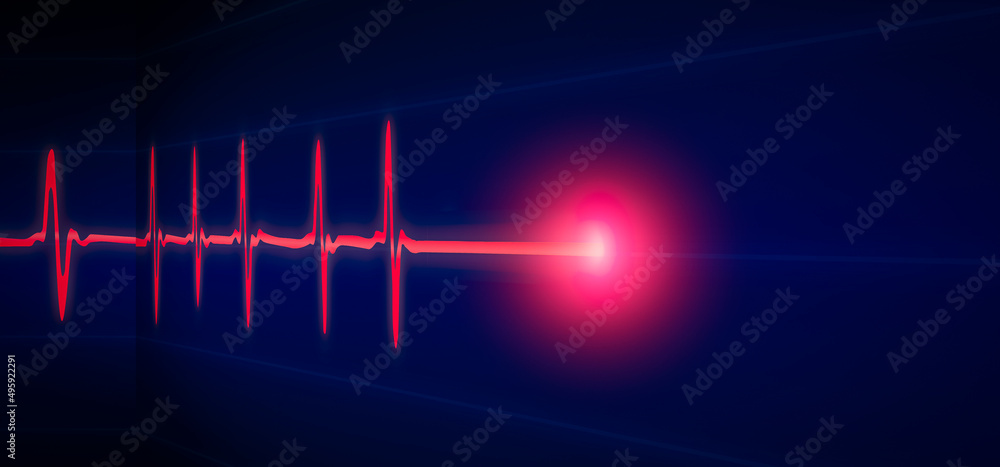 Patient monitor showing vital signs ECG and EKG. Vector illustration ...