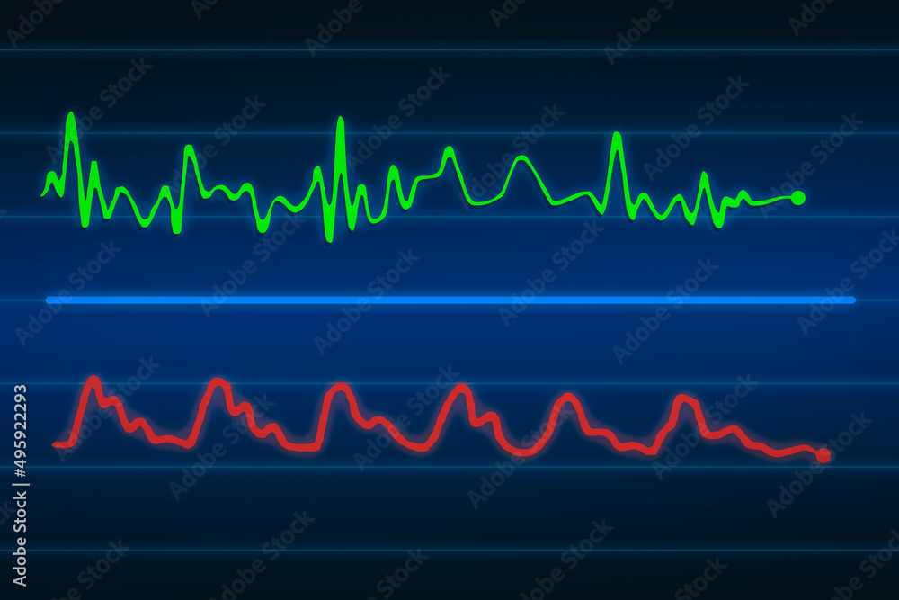 Patient monitor showing vital signs ECG and EKG. Vector illustration ...