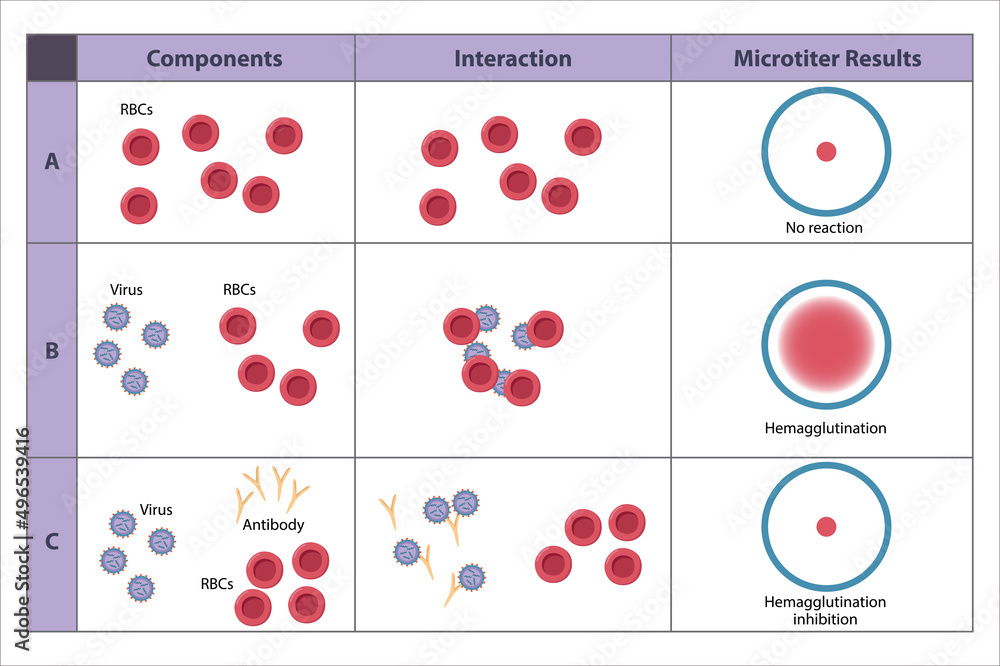 Possible Outcomes Of Hemagglutination Test Agglutination Of