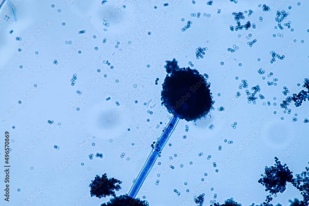 Foto de Aspergillus niger and Aspergillus oryzae (mold) under ...