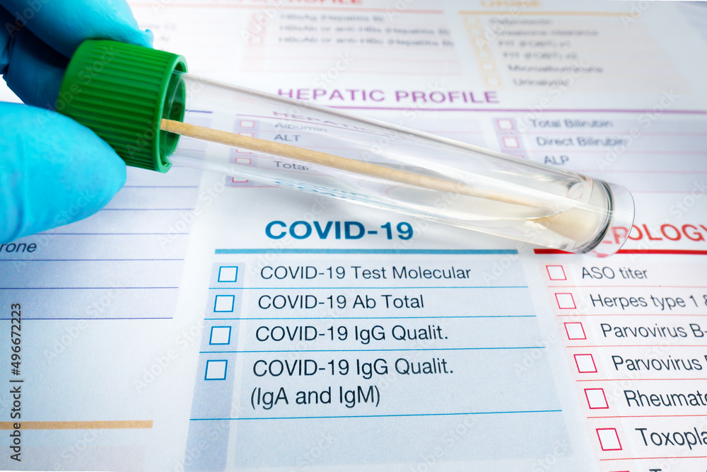 doctor holding tube with nasal swab and requisition form for analysis ...