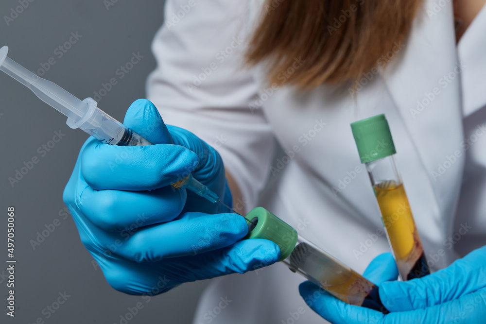 Beautician doctor's hands put test tube with blood in centrifuge ...