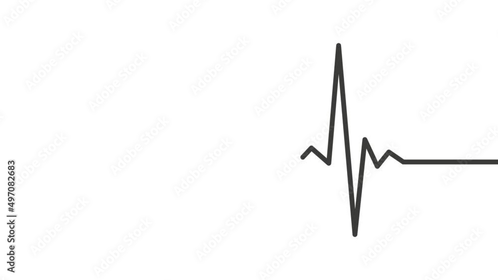 Cardiogram Electrocardiogram EKG ECG Animation | 2D Animated Heartbeat ...