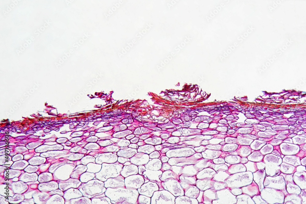 Venturia pyrina under the microscope Stock Photo | Adobe Stock